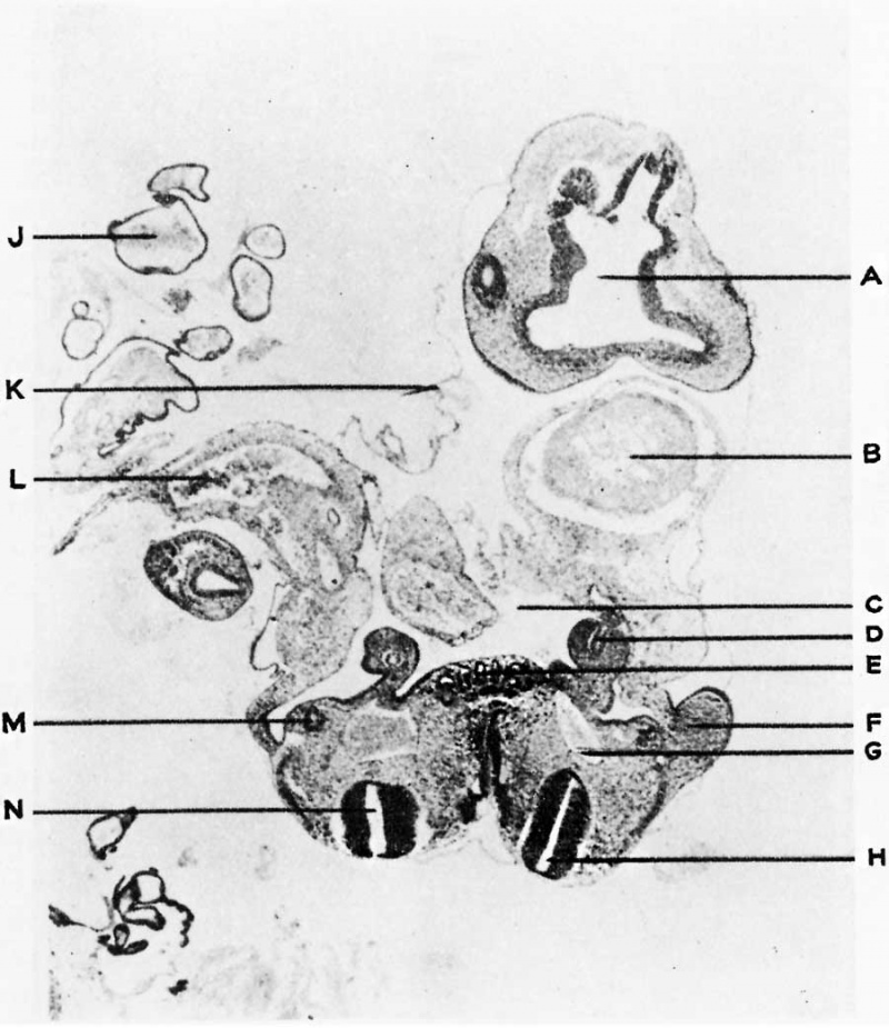 Paper - Observations on two specimens of early human ova - Embryology