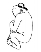 Abnormal Development - Anencephaly - Embryology