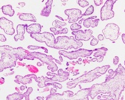 BGDA Practical Placenta - Villi Development - Embryology