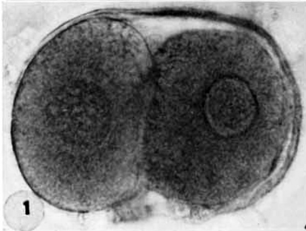 Carnegie stage 2 - Embryology
