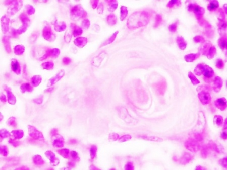 Thymus Development - Embryology