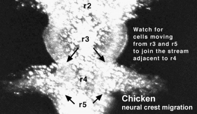 Chicken Neural Crest Migration Movie 3 - Embryology