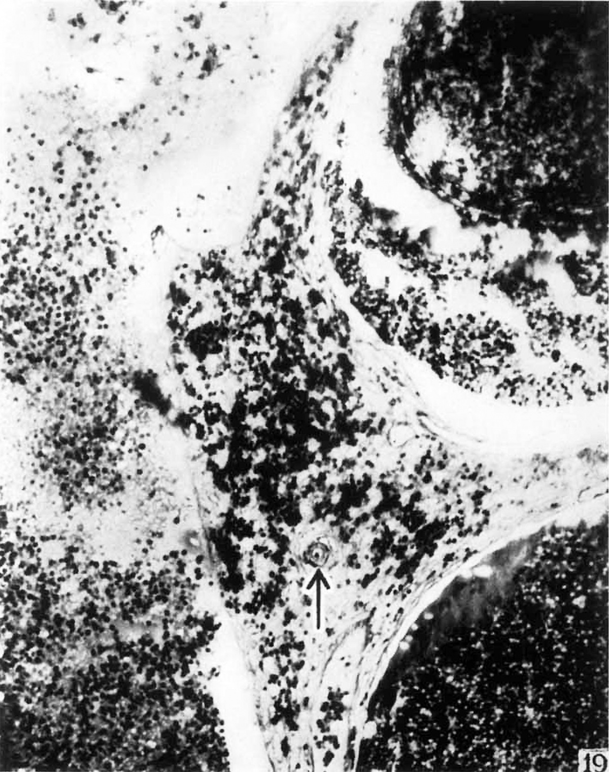 Paper - A normal human ovum in a stage preceding the primitive streak ...