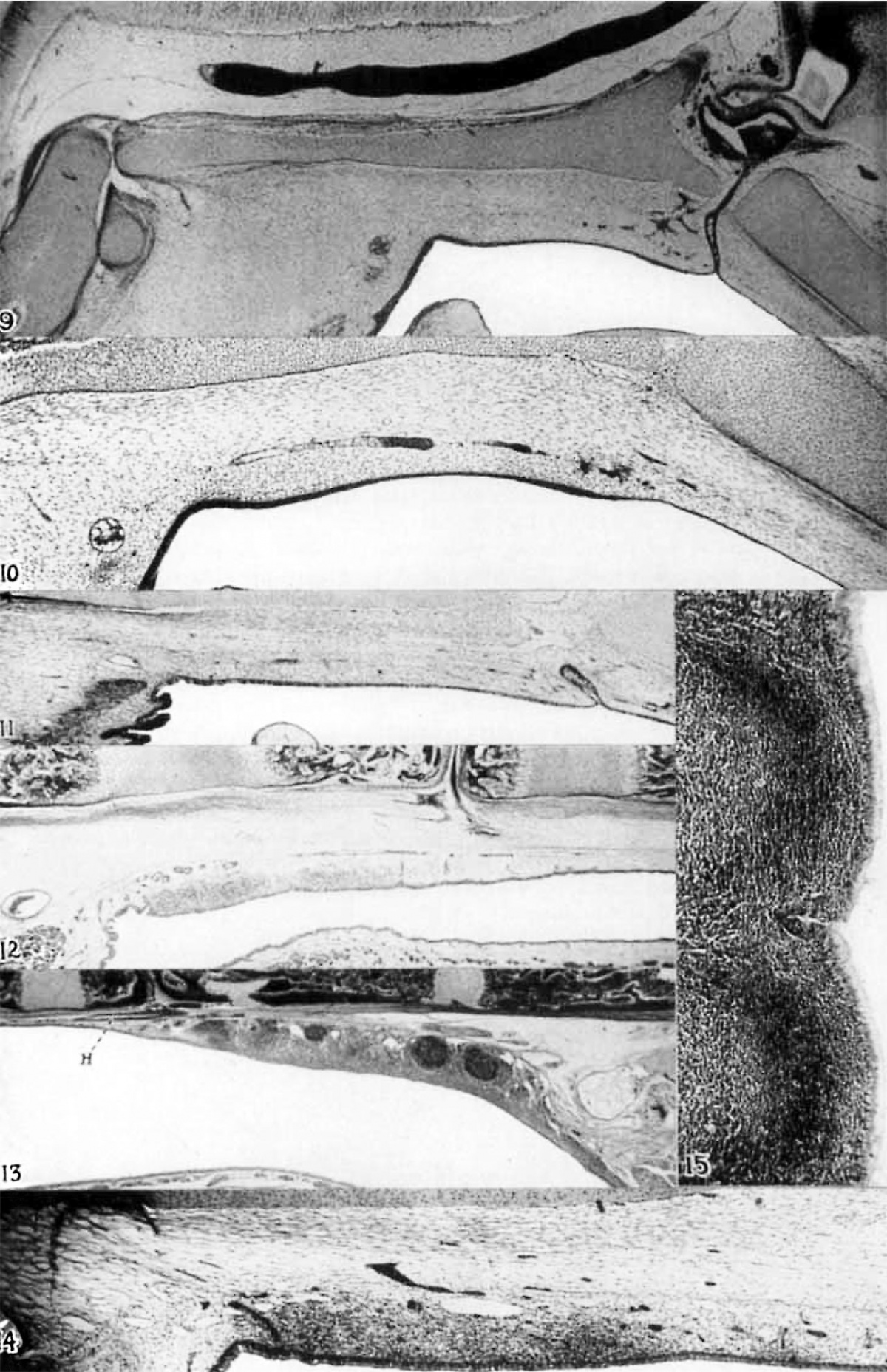 Paper - The developmental significance of the mammalian pharyngeal ...
