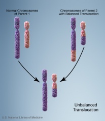 Trisomy 13 - Embryology