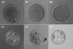 Carnegie stage 1 - Embryology