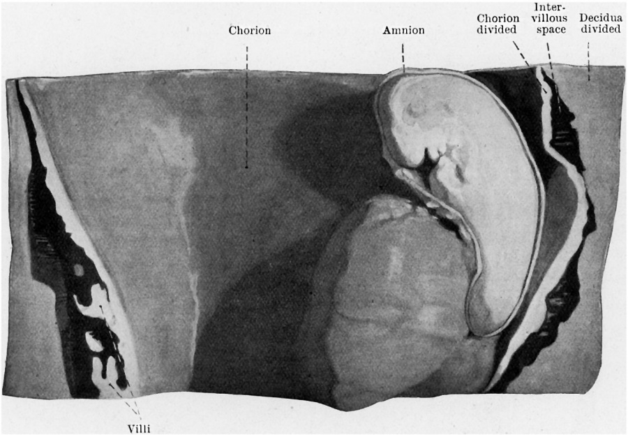 Paper - A very Young Human Embryo found embedded in a "Decidual Cast ...