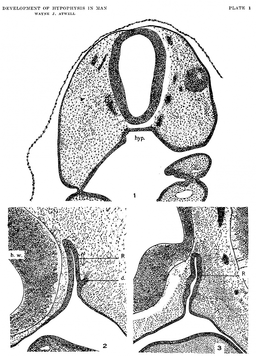 Paper - The development of the hypophysis cerebri in man (1926 ...