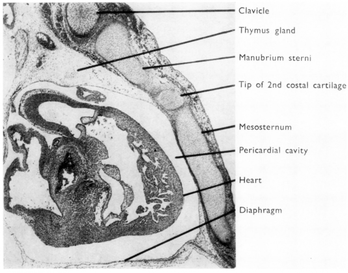Paper - Factors leading to the development of a joint between the ...