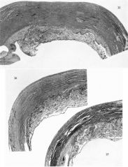 Paper - Development of the human placenta in the first three months of ...