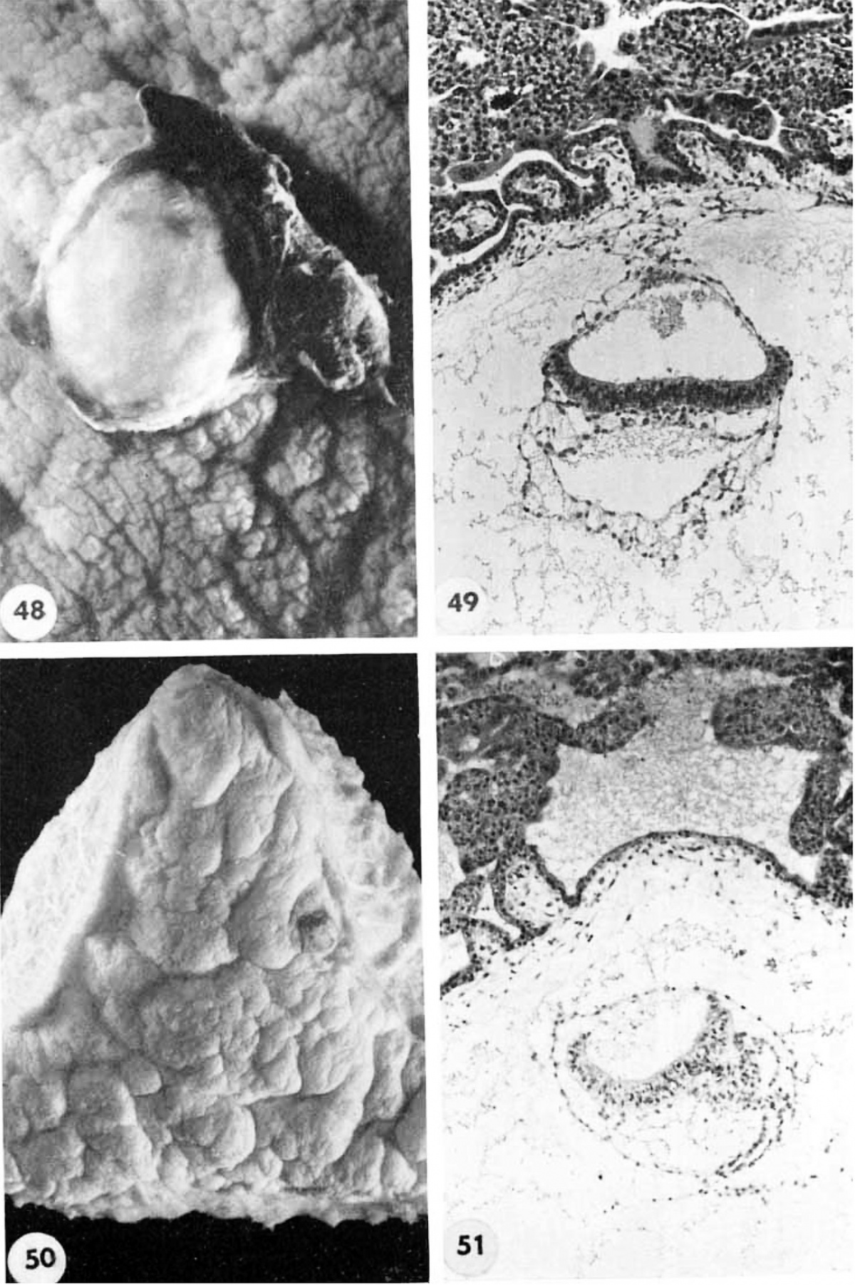 Paper - A description of 34 human ova within the first 17 days of ...