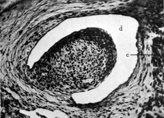 Paper - A morphological study of testicular descent - Embryology