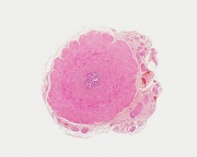 Sertoli cell - Embryology