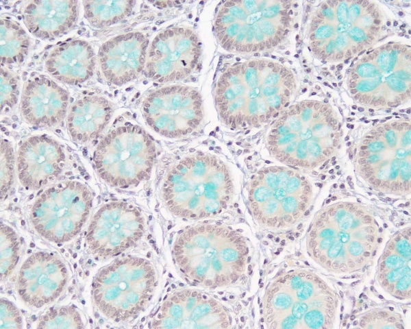 Gastrointestinal Tract - Colon Histology - Embryology