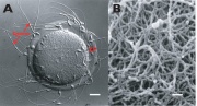 Zona pellucida - Embryology