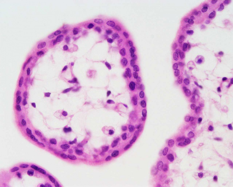 BGDA Practical Placenta - Villi Development - Embryology