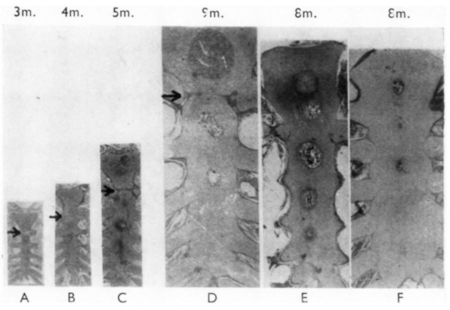 Paper - Factors leading to the development of a joint between the ...