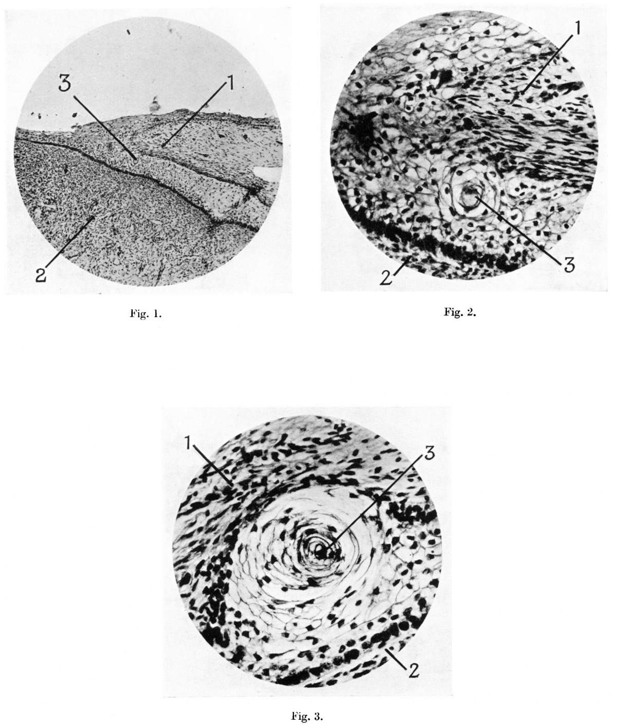 Paper - Notes on the development of the prepuce (1935) - Embryology