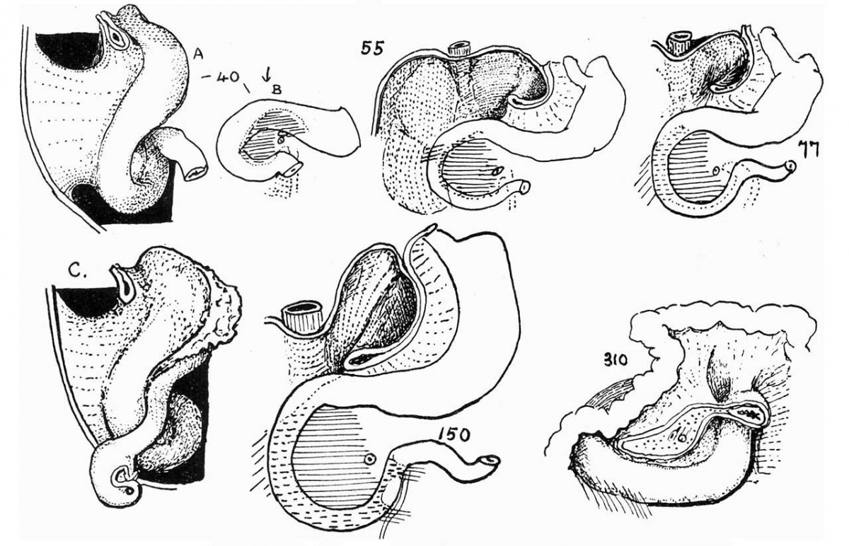 Paper - The formation of the duodenal curve - Embryology