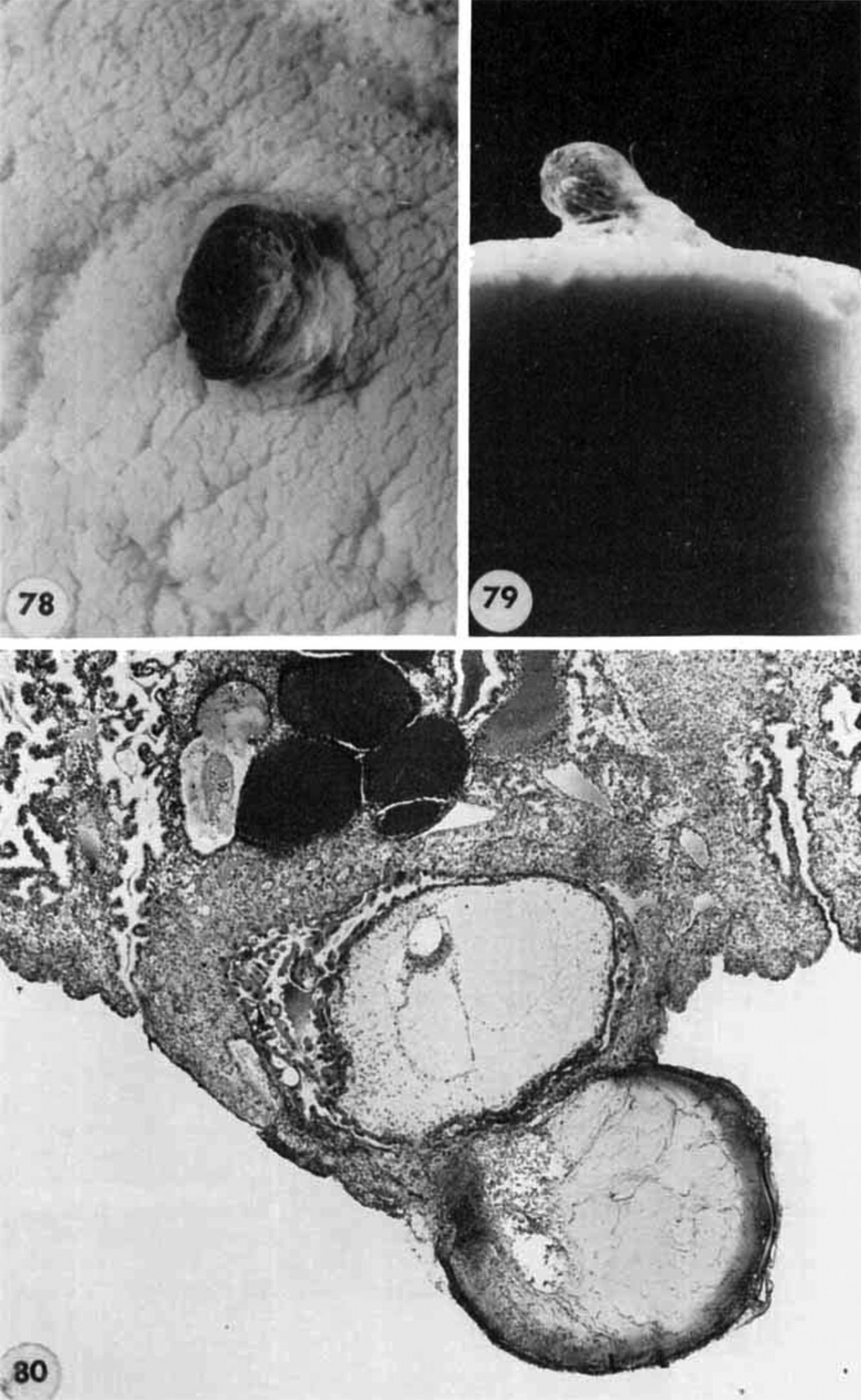 Paper - A description of 34 human ova within the first 17 days of ...