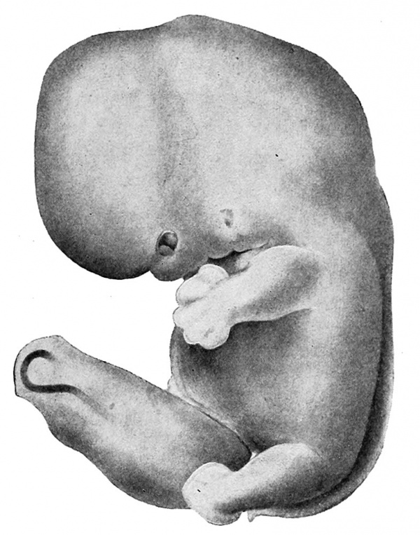 Paper - The Anatomy of a 17.8 mm Human Embryo - Embryology