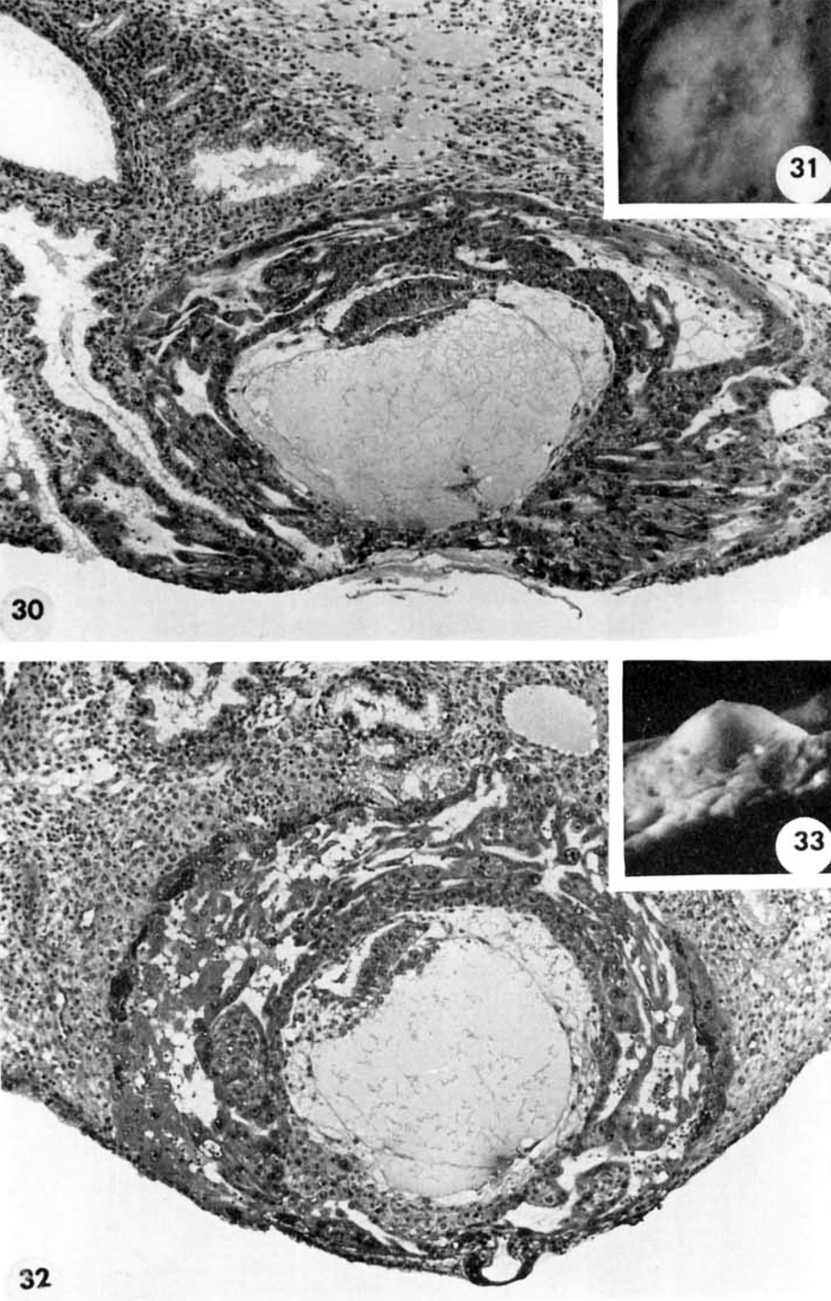 Paper - A description of 34 human ova within the first 17 days of ...