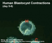 Blastocyst Development - Embryology