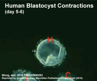Blastocyst Day 5-6 Movie - Embryology