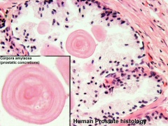 Prostate Development - Embryology