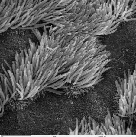 ANAT2241 Covering and Lining Epithelia - Embryology