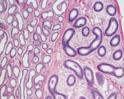Testis Development - Embryology