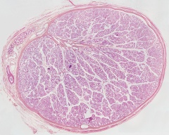 Sertoli cell - Embryology