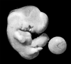 Embryology History - Franklin Mall - Embryology