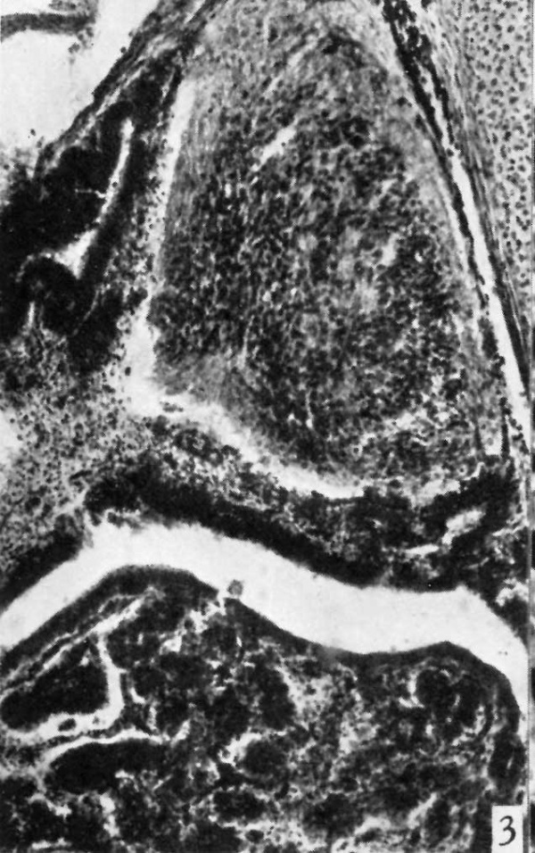 Paper - Differentiation of pituicytes in the human foetus - Embryology