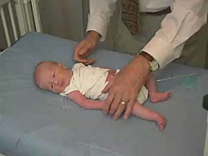 Neural Abnormal Exam - Newborn tone - hand position - Embryology