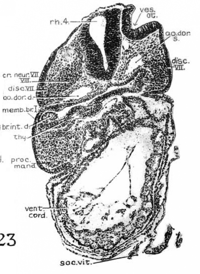 Paper - The Anatomy of Human Embryos with Seventeen to Twenty-three ...