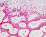 Musculoskeletal System - Bone Development - Embryology