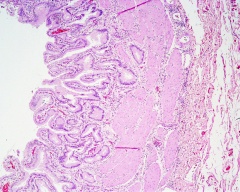 Gastrointestinal Tract - Histology - Embryology
