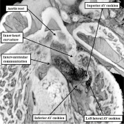 Category:Mouse E13.5 - Embryology