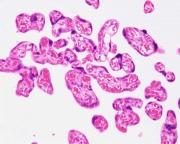 BGDA Practical Placenta - Villi Development - Embryology