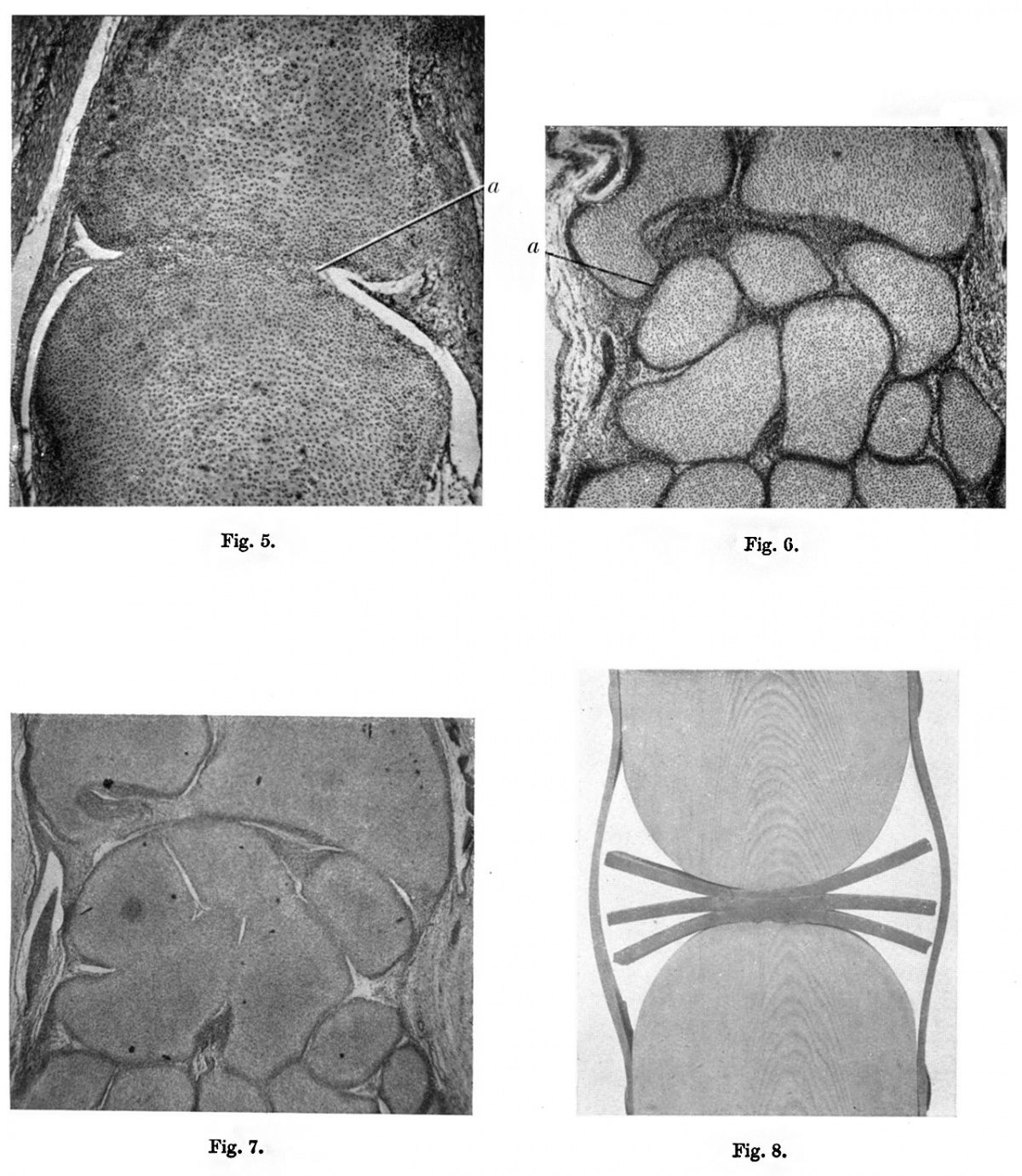Paper - The development of synovial joints - Embryology