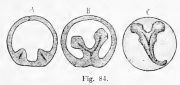 Abnormal Development - Twinning - Embryology