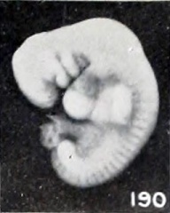Category:Carnegie Embryo 1380 - Embryology