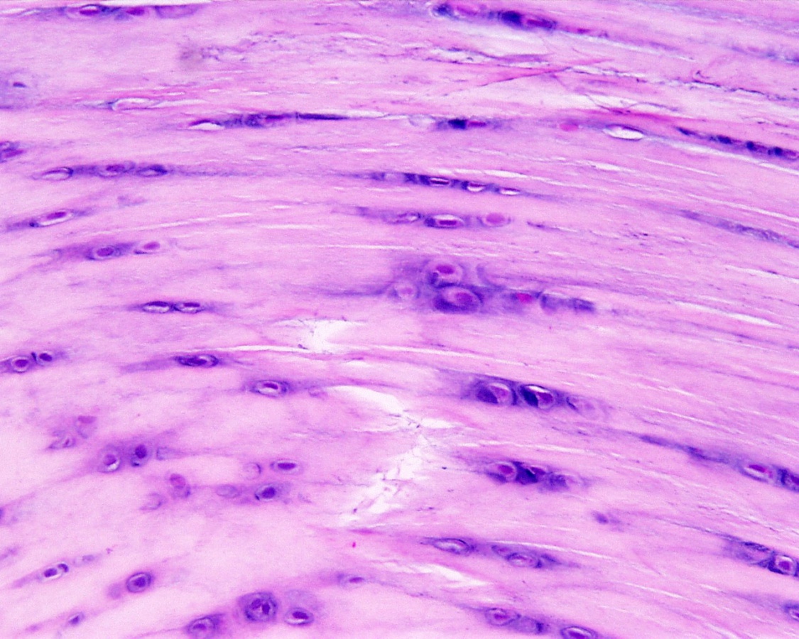 File:Bone histology 020.jpg - Embryology