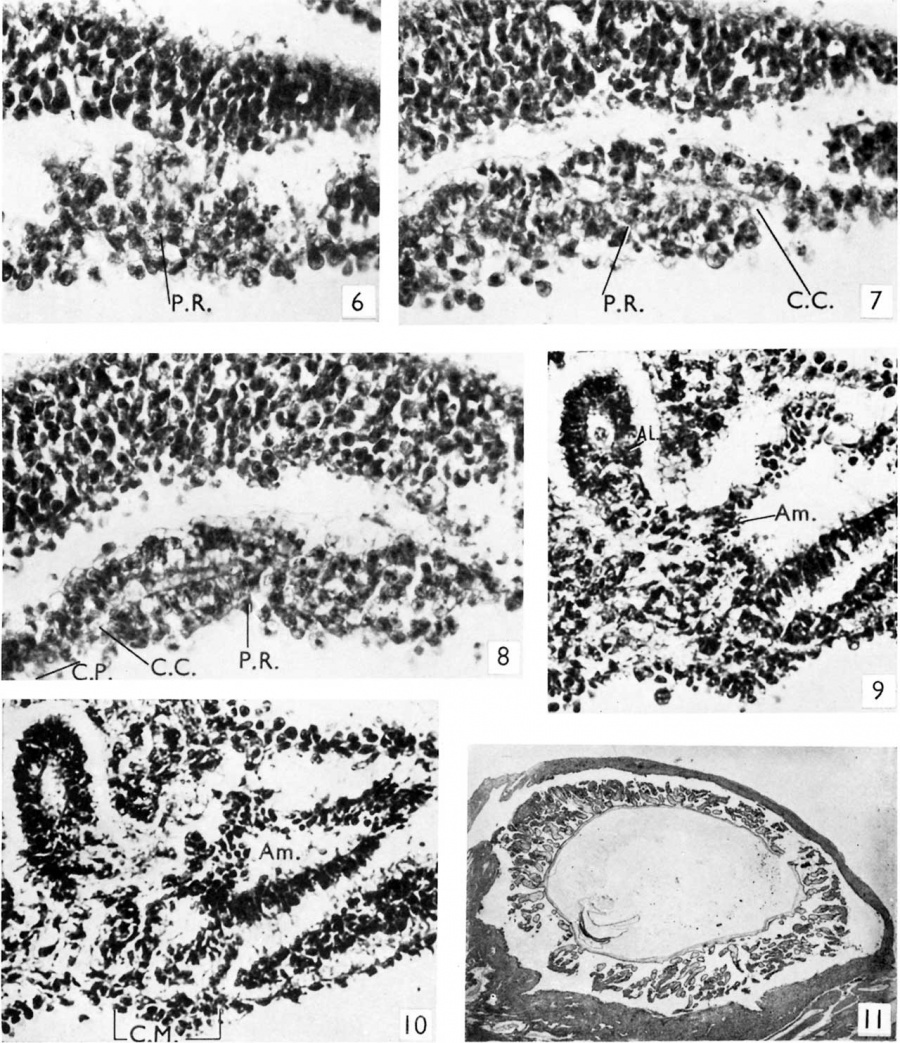 Paper - A presomite human embryo with a neurenteric canal (embryo R.S ...
