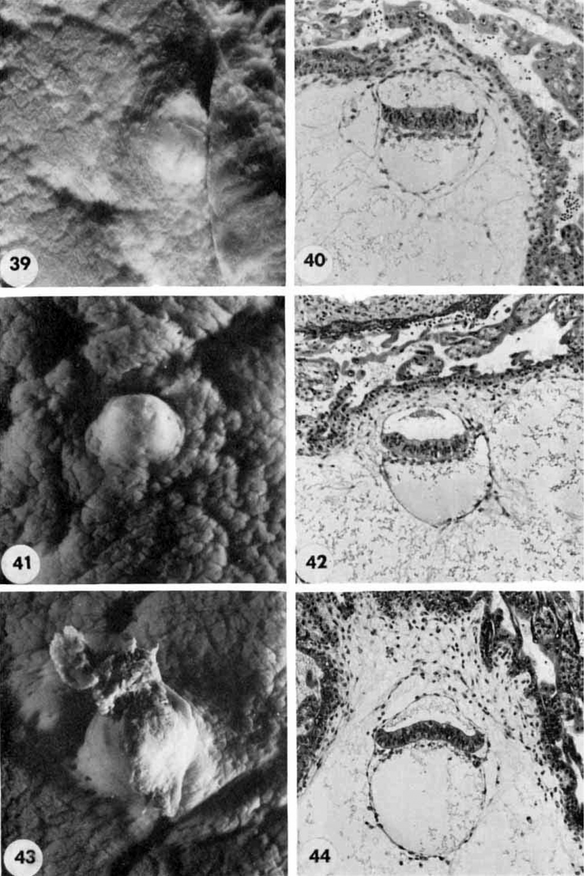 Paper - A description of 34 human ova within the first 17 days of ...