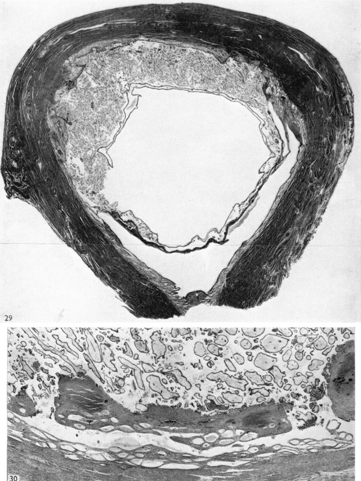 Paper - Development of the human placenta in the first three months of ...