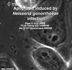 Developmental Mechanism - Apoptosis - Embryology