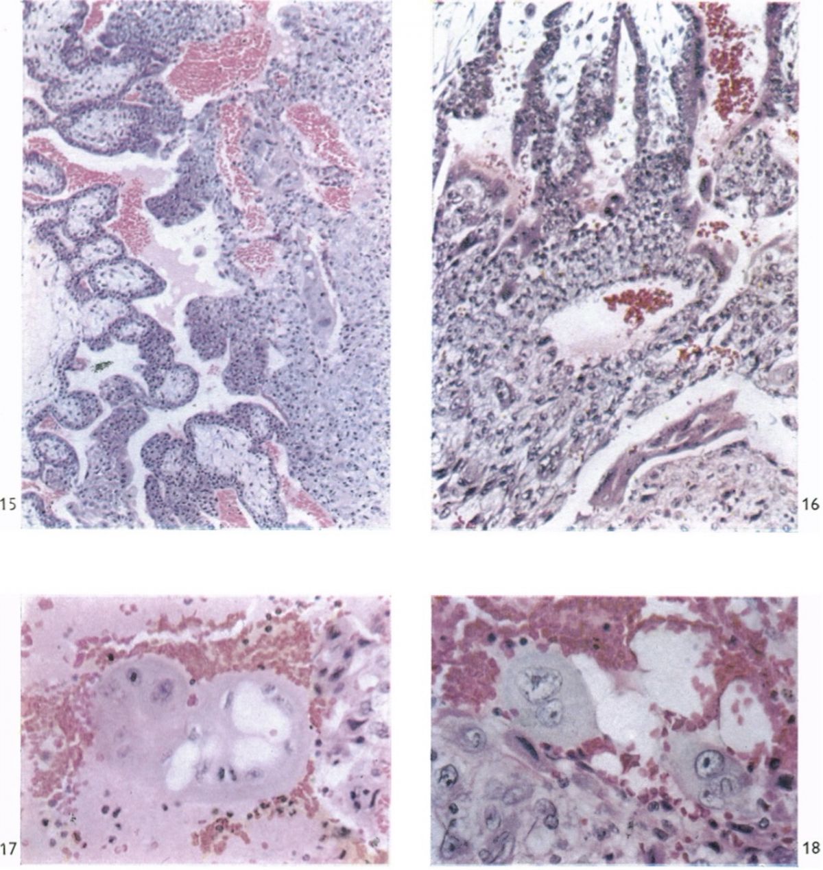 Paper - Development of the human placenta in the first three months of ...