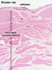 Urinary Bladder Development - Embryology
